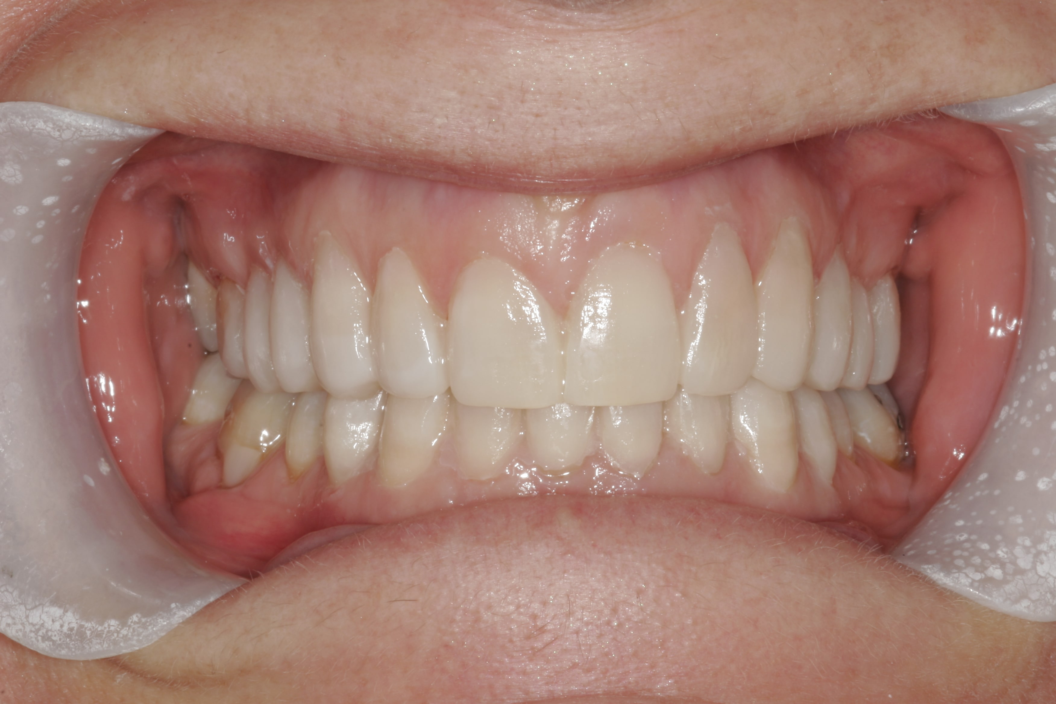 Takapuna Como Street | Takapuna Dentist | Lumino The Dentists